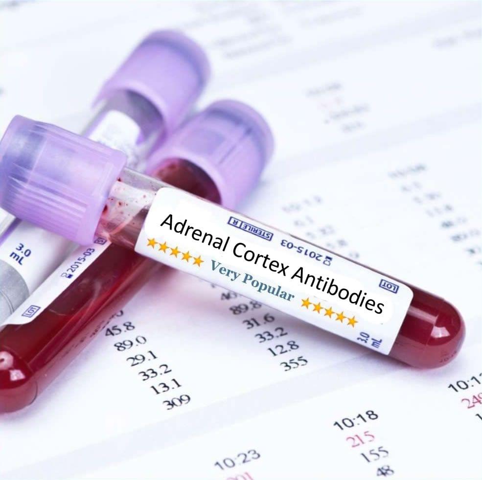 Adrenal Cortex Antibodies Blood Test In London - Order Online – Blood ...