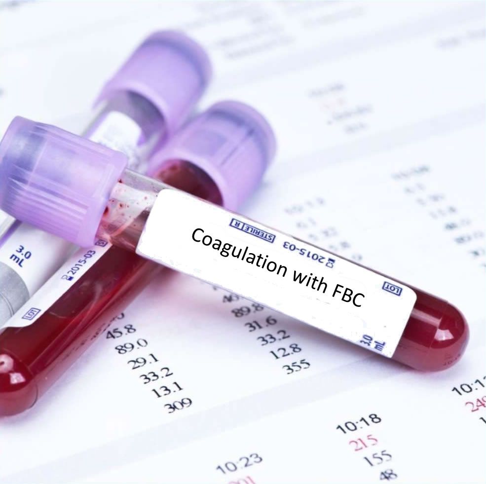 Coagulation Profile with FBC Blood Test Profile In London – Blood Tests ...